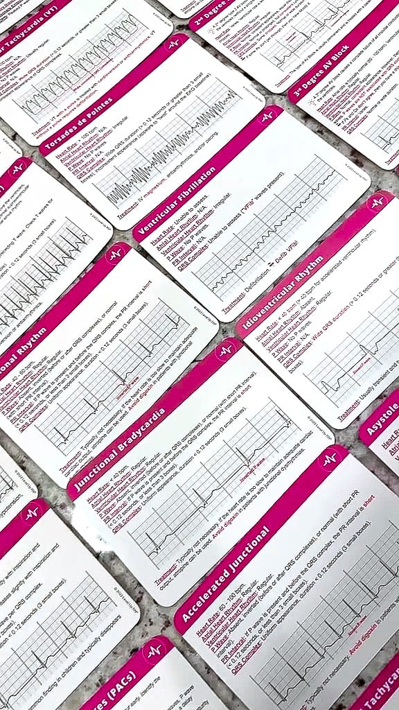 EKG Interpretation - Nursing Flashcards – LevelUpRN